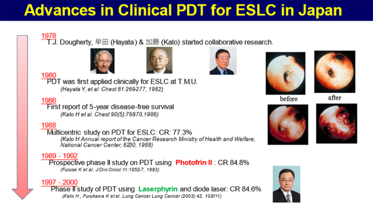 肺癌のPDT | 日本光線力学学会（JPA）